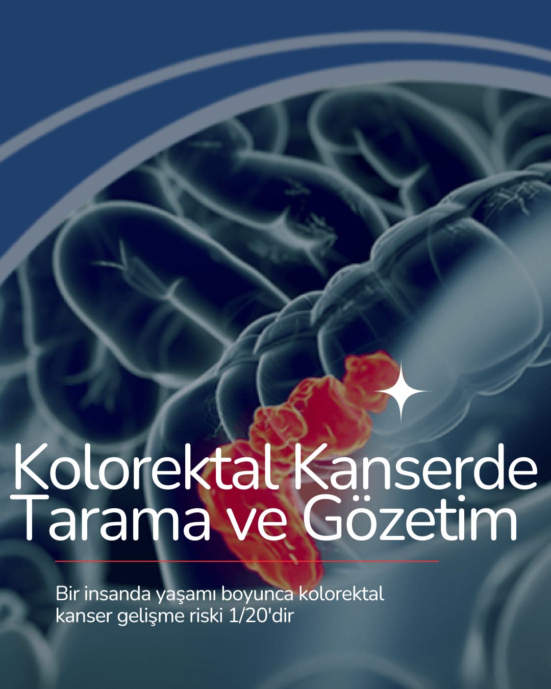 Kolorektal Kanserde Tarama ve Gözetim – Prof. Dr. Oktar ASOĞLU